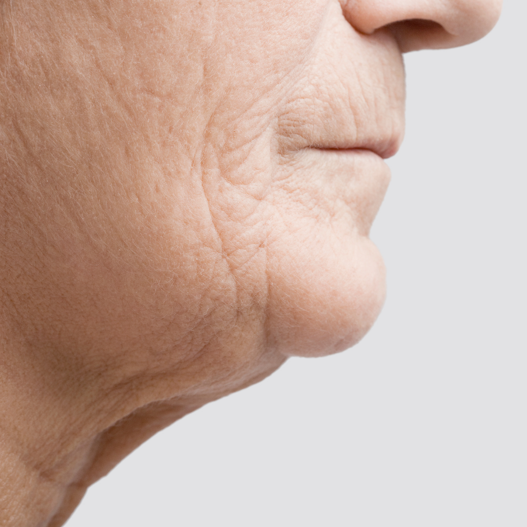 What is the limit of human lifespan? – QYRAL